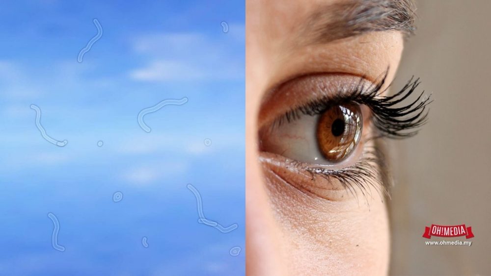 Kenali ‘Eyes Floaters’ Dan Apakah Kaitannya Kepada Kesihatan Mata? | Oh ...